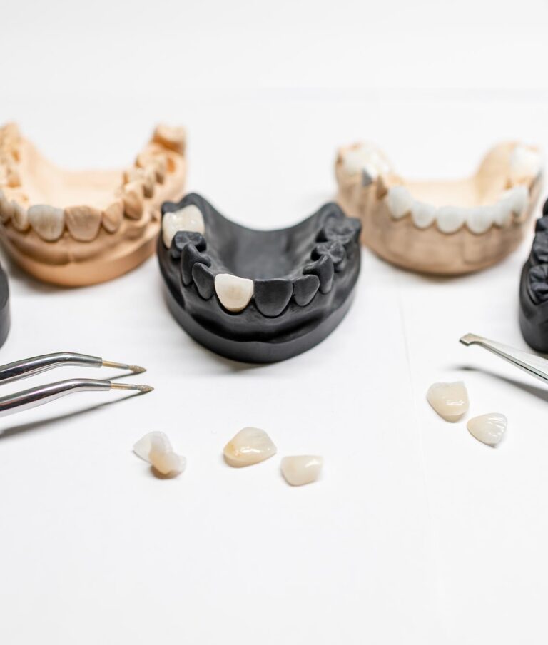 Zobu protezēšana Rīgā - protezēšanas veidi un cenas