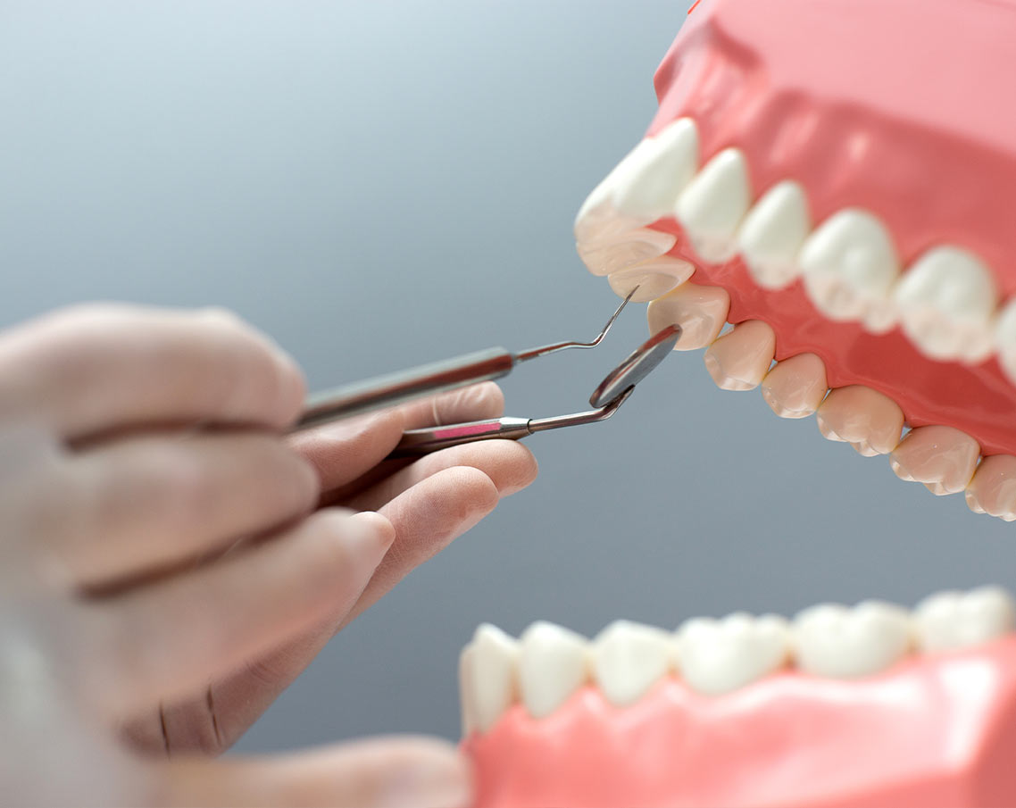 Zobu protezēšana Rīgā - protezēšanas veidi un cenas